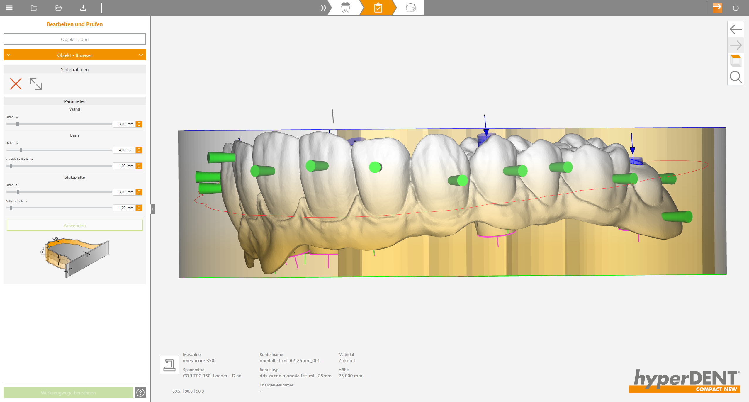 hyperDENT® Compact NEW - desktop dry | digital dental solutions