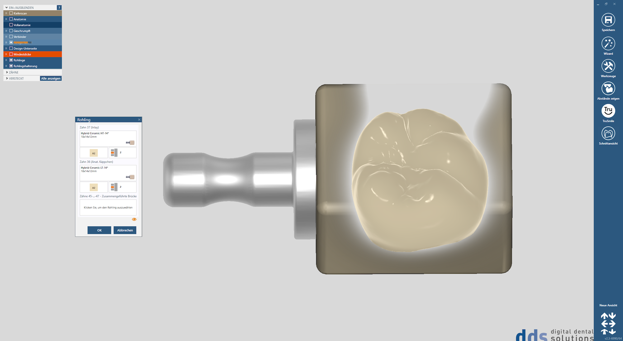 dds dentalCAD nesting module | digital dental solutions
