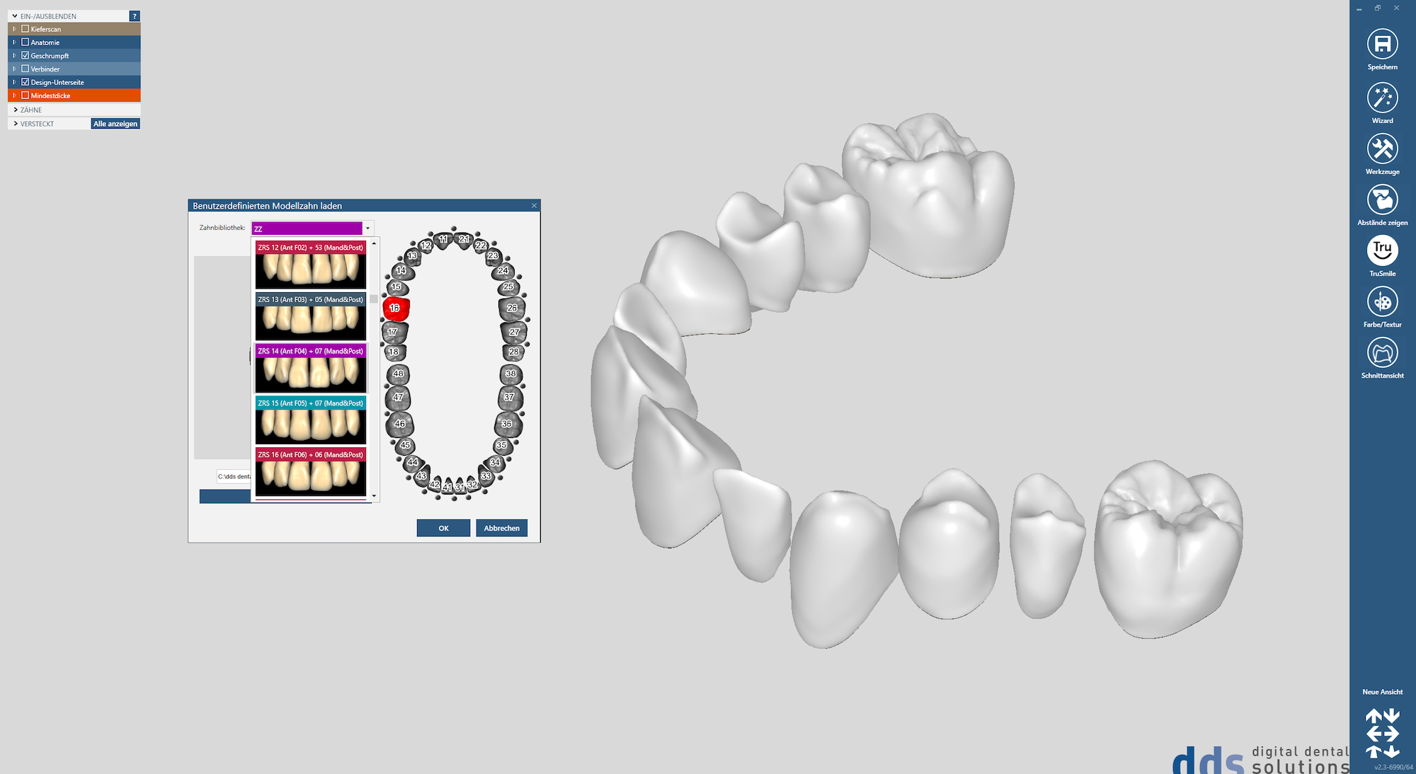 tooth library ZRS Wiedmann | digital dental solutions