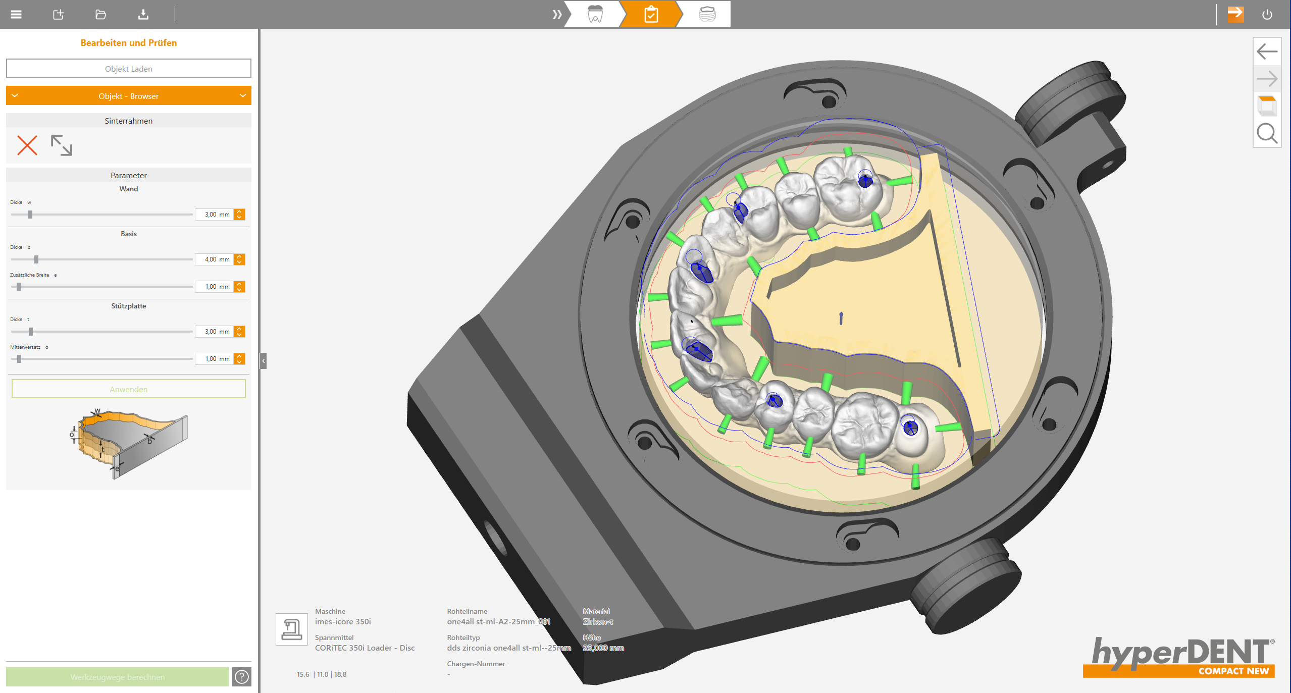 hyperDENT® V10 | digital dental solutions