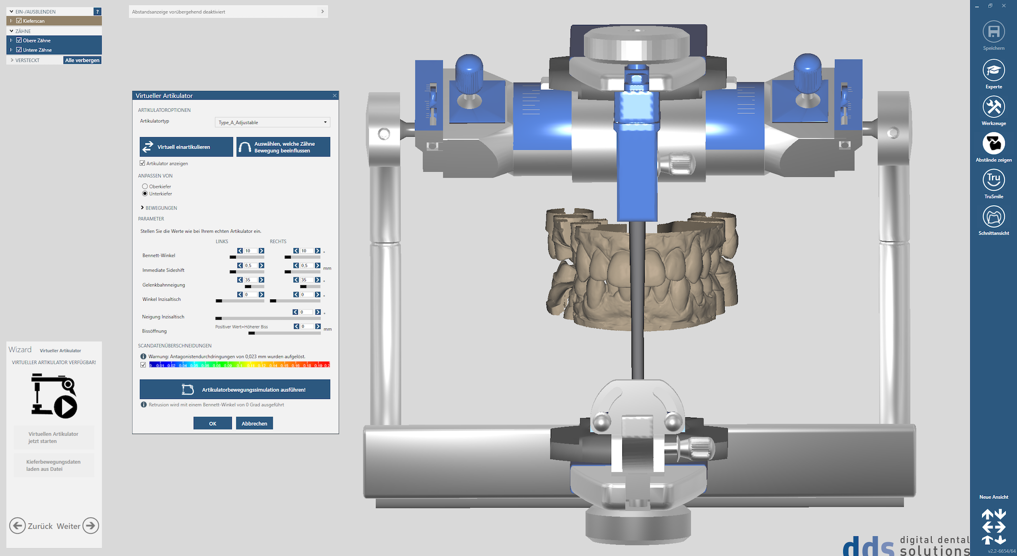 dds dentalCAD virtual articulator module | digital dental solutions