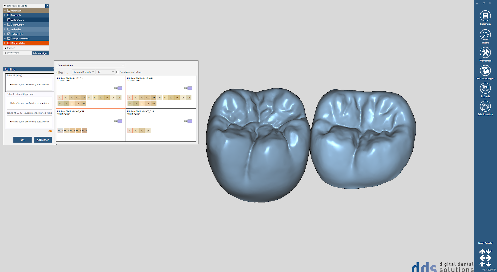 dds dentalCAD inCAD nesting module | digital dental solutions